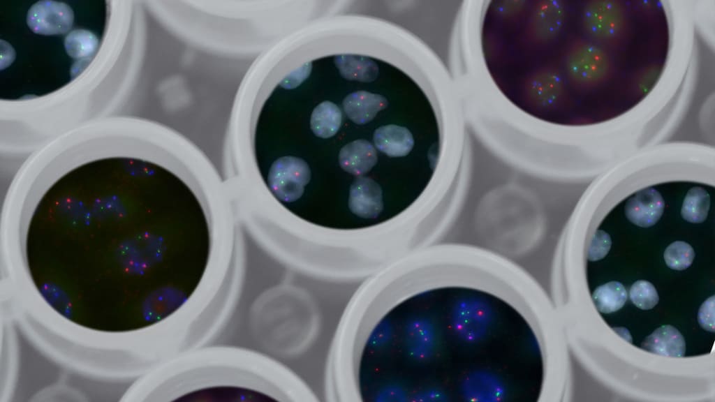 Abbott Laboratories Case Study | AlixPartners