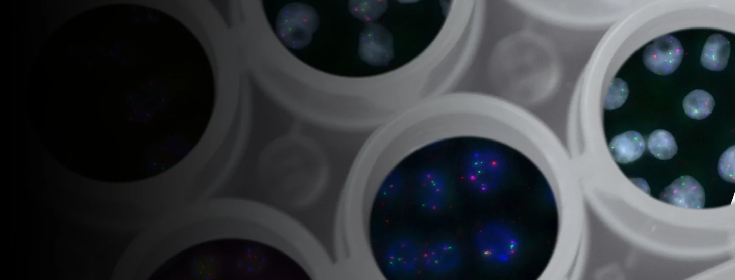 Abbott Laboratories Case Study | AlixPartners